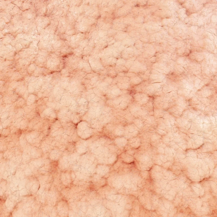 Pink Flesh PBR Texture